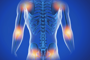 Sports Medicine | Steindler Orthopedic Clinic